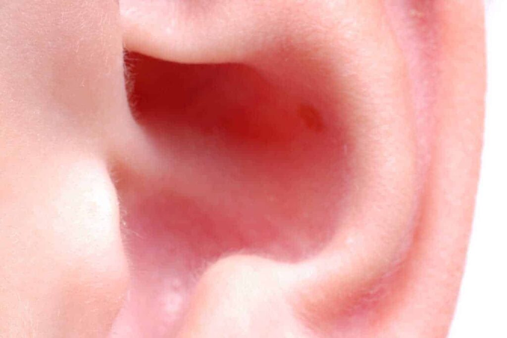 Sifflement oreille gauche : causes, significations mystiques et ...
